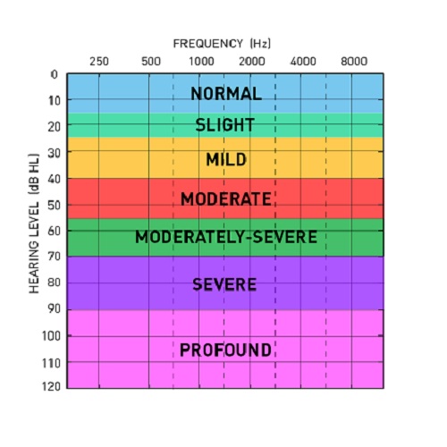 What Is An Audiogram Understanding Hearing Test Results What Is An Audiogram Understanding Hearing Test Results